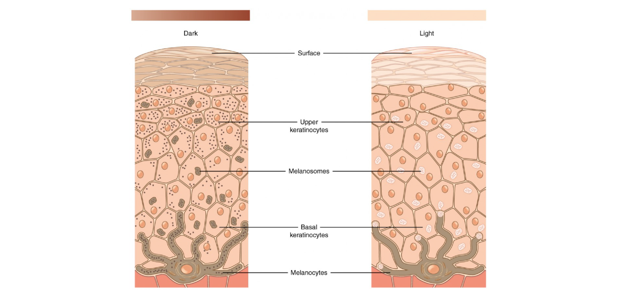Is Melanin that Causes Dark Spots on Our Skin Good or Bad? - UR Klinik ...