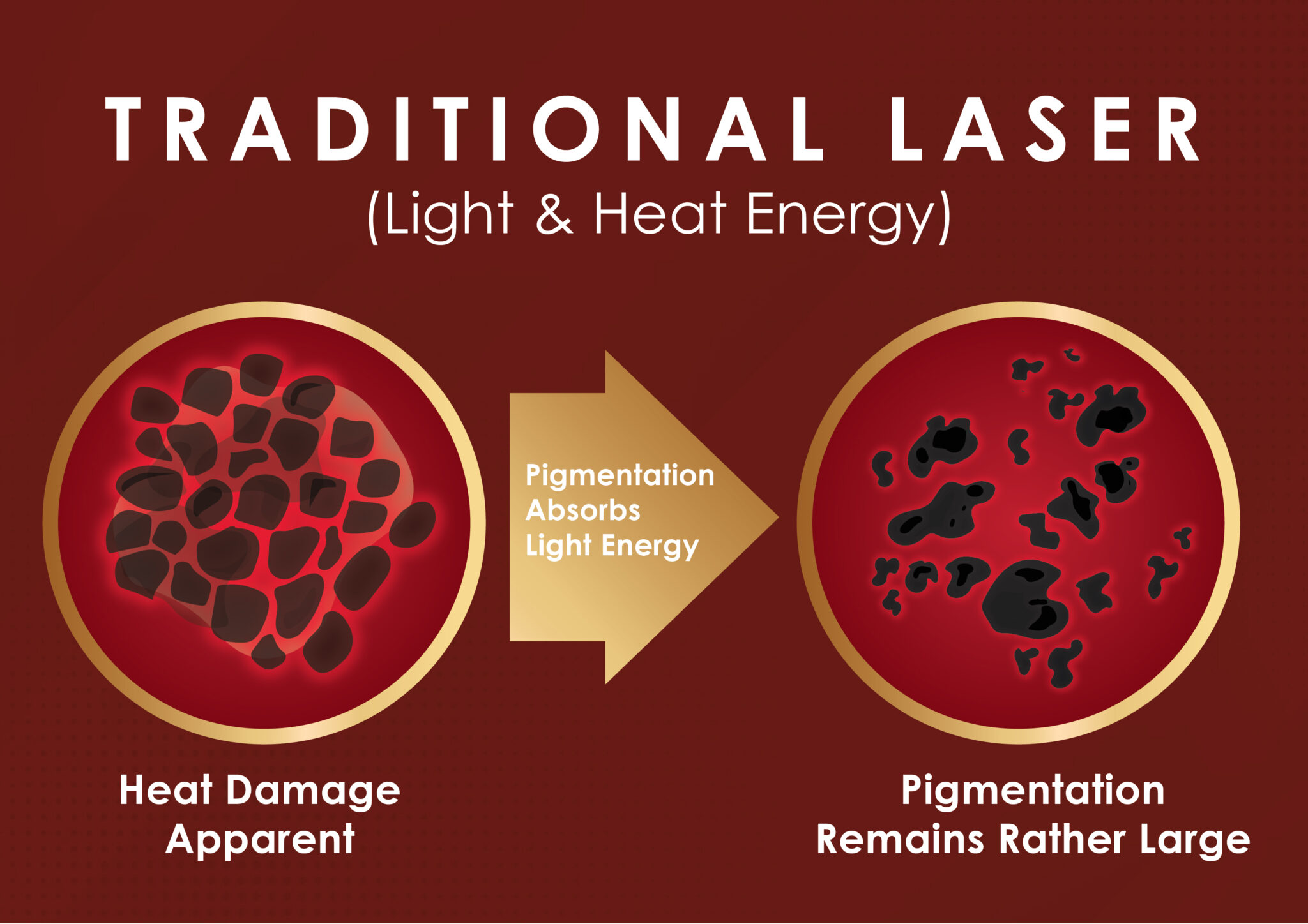 Our Treatment - UR Klinik | Skin Pigmentation Treatment Malaysia