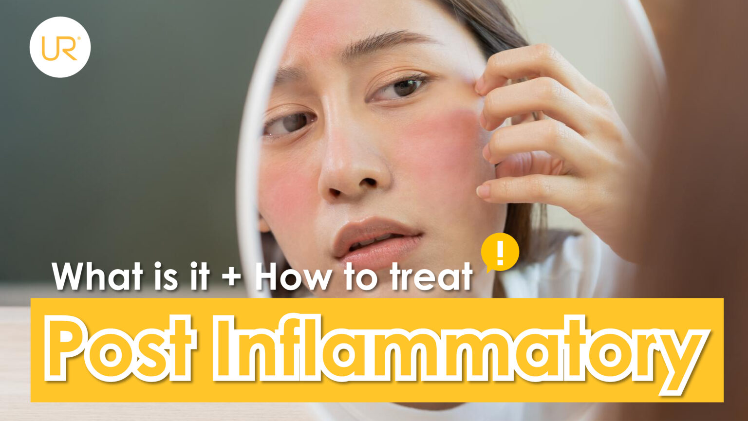 What is Post Inflammatory Hyperpigmentation? How can we treat Post ...